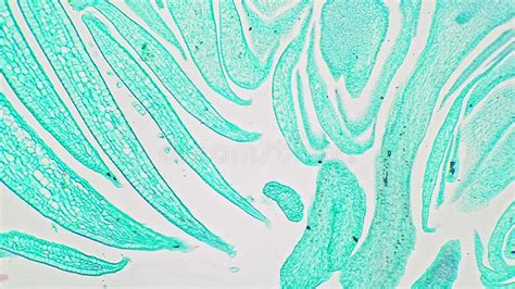 Transversal Section On Pinus Leaf Filmed Under Microscope With 40x