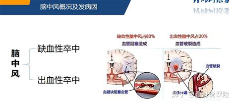 脑中风后遗症～理赔手册 知乎