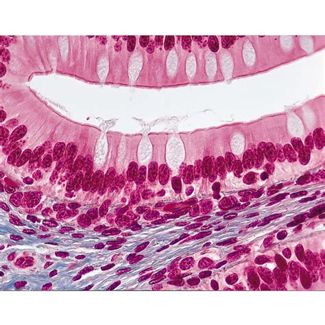 Simple Columnar Epithelium Slide