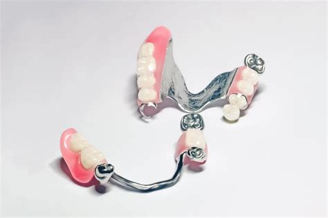 Chrome Dentures Specialist Denture Solutions The Mobile Denture
