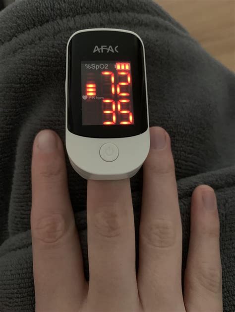 Anyone Tried A Pulse Ox Reading Rraynauds