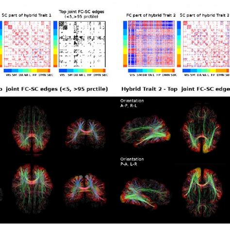 Pdf Mapping Hybrid Functional‐structural Connectivity Traits In The Human Connectome