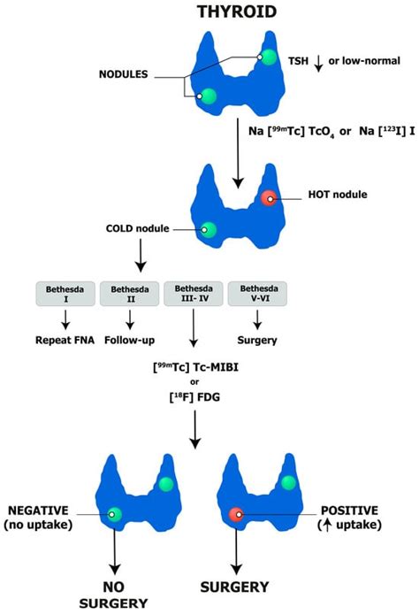Integrated Diagnostics Of Thyroid Nodules