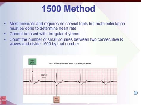 Basic Dysrhythmia Interpretation Pptx Heart And Cardiovascular