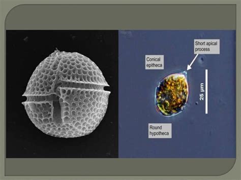 Morphology Of Protozoa Pptx Infectious Diseases Diseases And Conditions