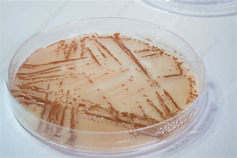 Stool Culture Stock Image F0273094 Science Photo Library