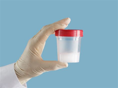How Do Men Donate Sperm How Do Men Donate Sperm