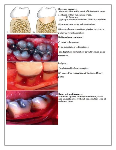 Bone Loss Patterns Pdf Bone And Joint Conditions Diseases And