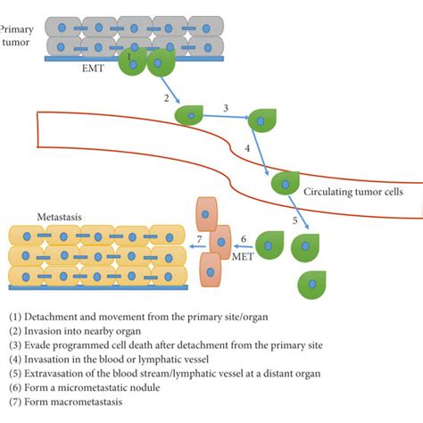 Emt In Cancer Metastasis A Schematic Representation Of The Role Of