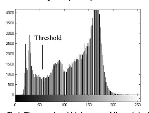Figure 1 From The Algorithm Of Iris Image Preprocessing Semantic Scholar