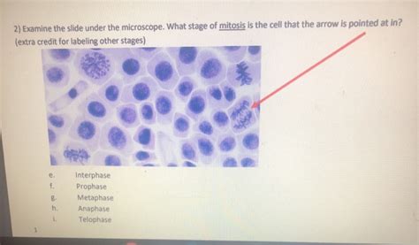 Anaphase Under Microscope