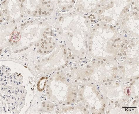 Detection Of Rare Cell Populations 60 Cellsm2 Of Tissue Image Analysis Imagesc Forum