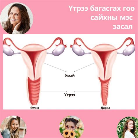 Эмэгтэйчүүдийн Солонгос улсын Сөүлд байрлах эмэгтэйчүүдийн эмнэлэг нь Үтрээ багасгах гоо