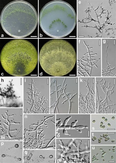 Clonal Species Trichoderma Parareesei Sp Nov Likely Resembles The
