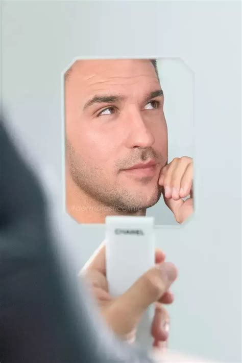 Brotox Botox For Men Price Video Before And After