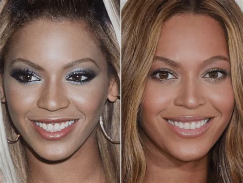 Beyonce Teeth Before And After Smile Analysis