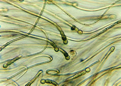Gloeotrichia Alchetron The Free Social Encyclopedia