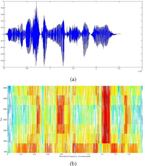 Figure 1 From Detecting Human Emotion Via Speech Recognition By Using