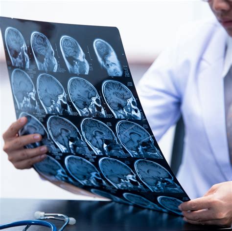 fnirs investigation of brain activity cognitive function and sleep