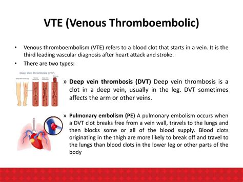 Vte Assessment And Prophylaxisppt