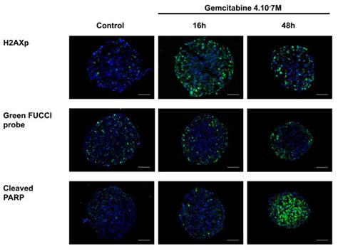 Spatio Temporal Response Of Capan 2 Spheroid To Gemcitabine Analysis