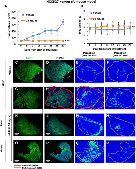 Erlotinib‐sensitive Mouse Xenograft Model With Hcc827 Cells And Download Scientific Diagram