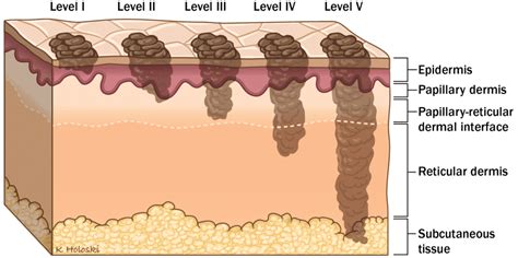 Skin Cancer ‣ Anatomy ‣ Thanc Guide