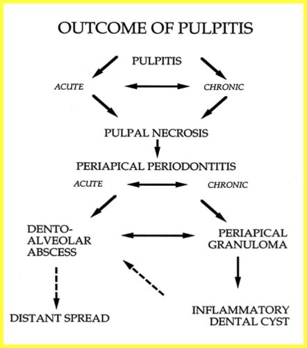 Microbiology Of Dental Abscesses Flashcards Quizlet