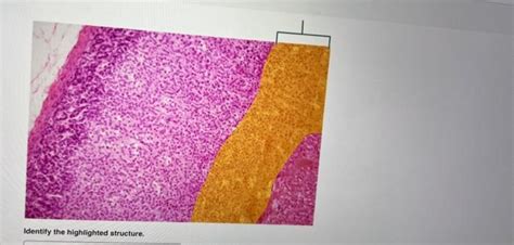 Solved Identify The Highlighted Structure Identify The