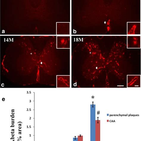 The Intracisterna Magna Injected Tracer Distributed Along Spinal Cord