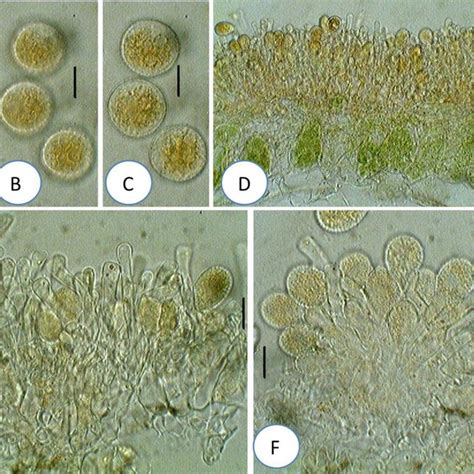 Different Stages Of Rust Infection On Oxalis Corniculata A Healthy