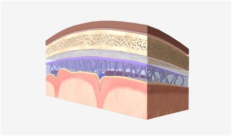 Premium Photo The Decrease In Intracranial Pressure