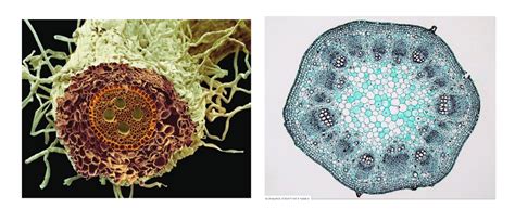 Diagramme De Dicot Root And Stem Micrograph Quizlet