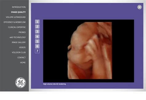 Ge Voluson E10 Ultrasound Machine At ₹ 3000000 Sunny Enclave Sas Nagar Id 2853299071062