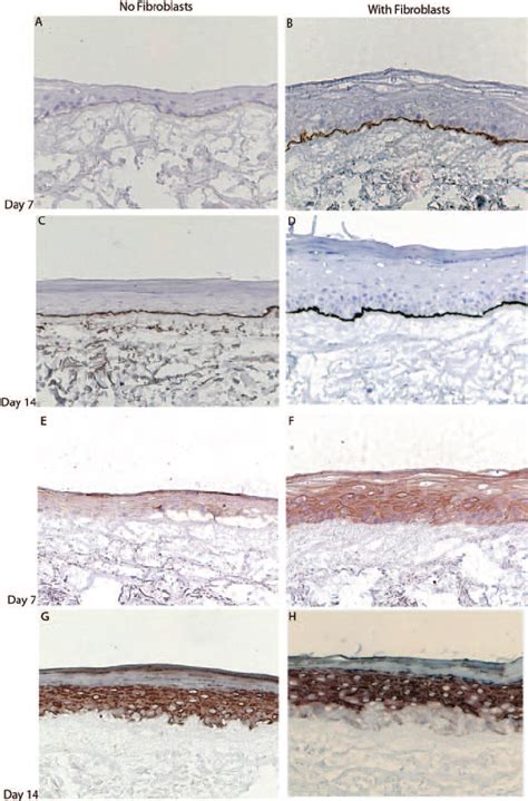 Staining For Basal Membrane Component Collagen Vii And Cytokeratin 17 Download Scientific