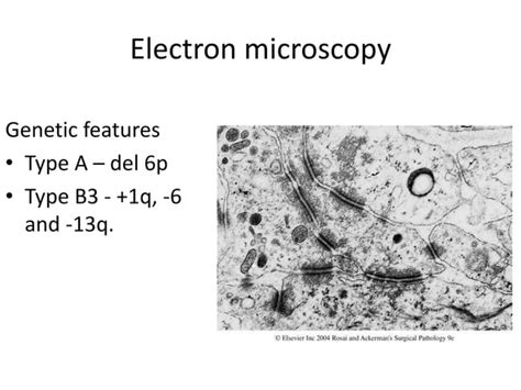 Pathology Of Thymus Pptx