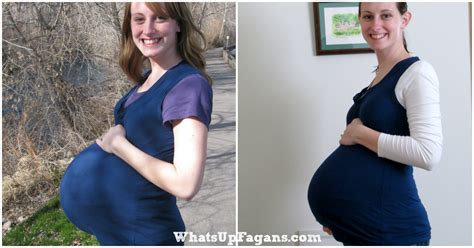 Twin Pregnancy Vs Singleton Pregnancy