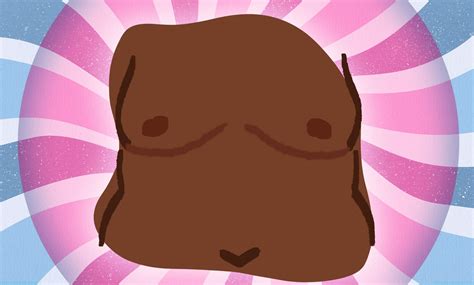 Top Surgery Improves Quality Of Life For Young Trans People According To Science Altabears Place