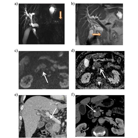 Imaging Parameters For Mrcp Sequences Download Scientific Diagram
