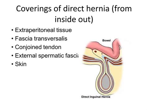 Hernia Pptx