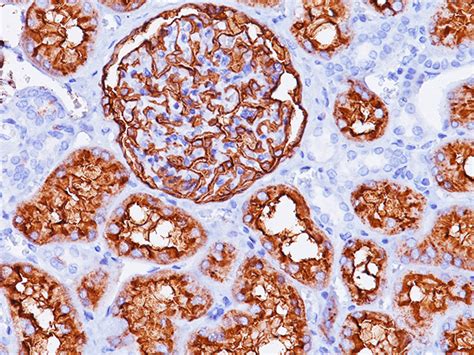 Cd10 Antibody Calla Order Online Biocare