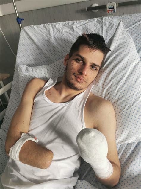 Help Us Provide 2 Bionic Prostheses For Raul Gogetfunding