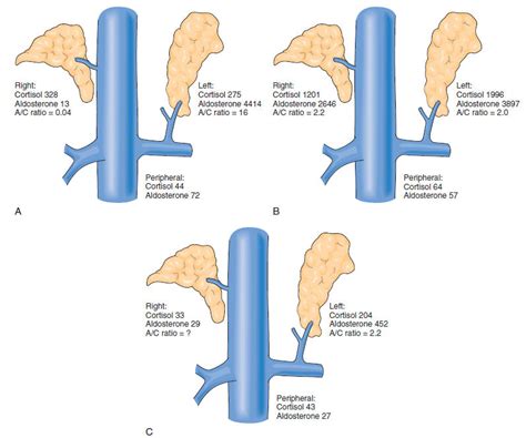 Surgicalcore Table Figure