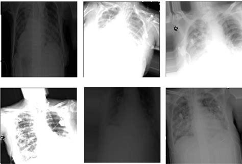 Example Of Data Augmented By Applying Different Transformations Table