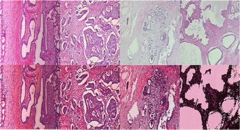 Examples Of Stain Normalization Process Using Non‐linear Mapping Stain