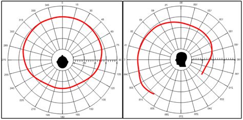 Acoustics Acoustics Added A New Photo