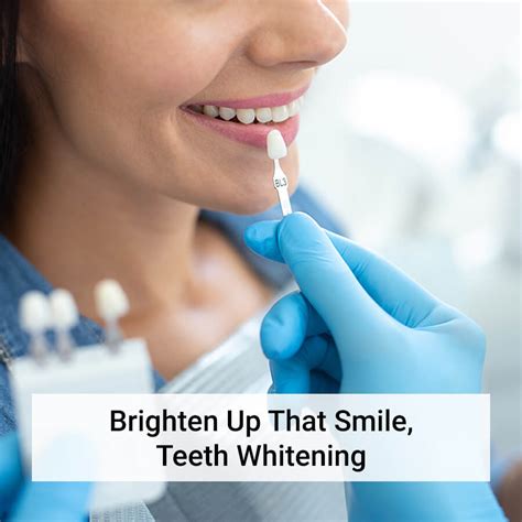 Teeth Whitening Dentist In Las Vegas Nv 89129