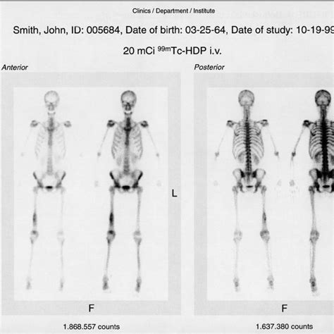 Diagnostic Thyroid Scintigraphy Download Scientific Diagram