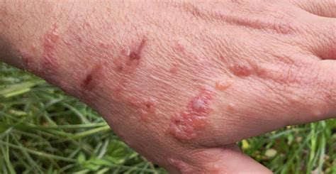 11 Types Of White Wildflowers In Colorado 2025 Bird Watching Hq