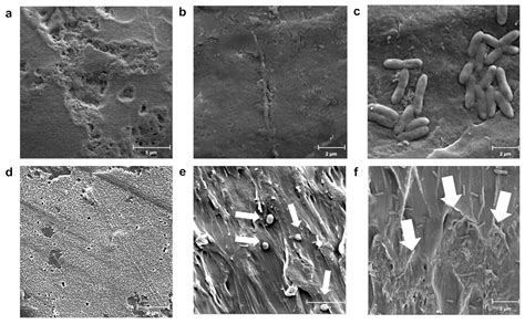 Polystyrene Degradation By Exiguobacterium Sp Rit 594 Preliminary